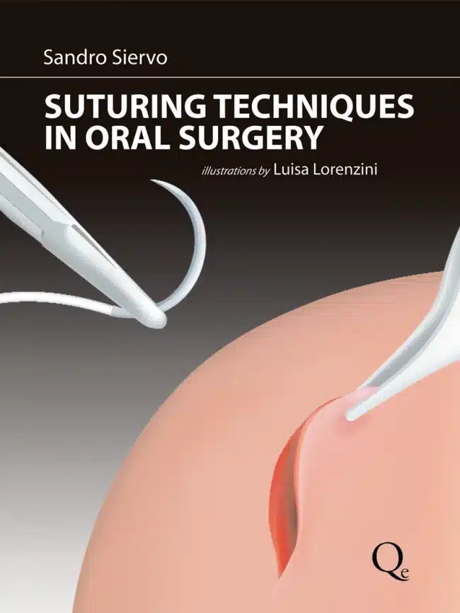 Suturing Techniques In Oral Surgery | DentWoo
